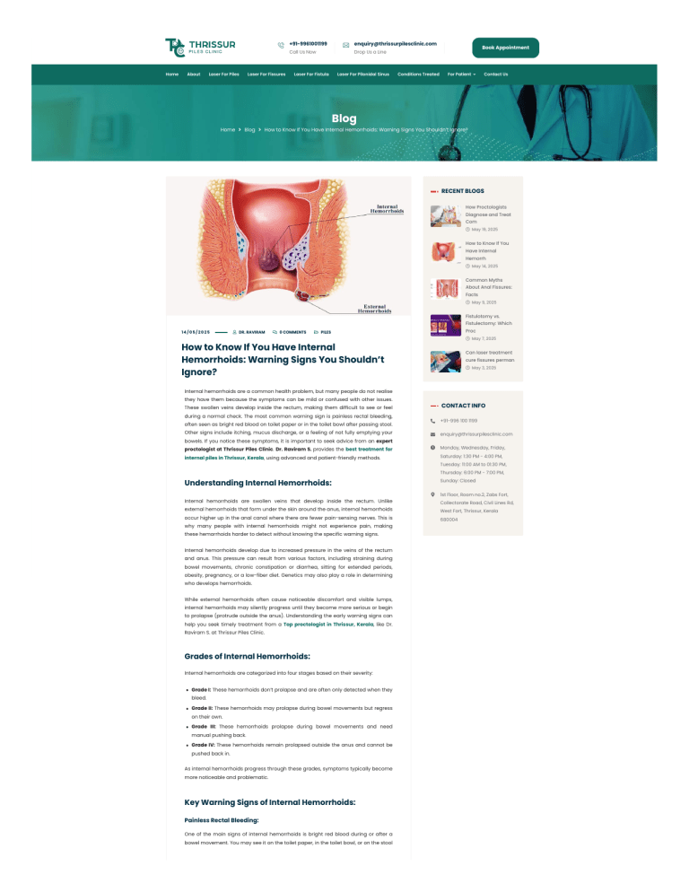 Internal Hemorrhoids: Symptoms, Diagnosis & Treatment